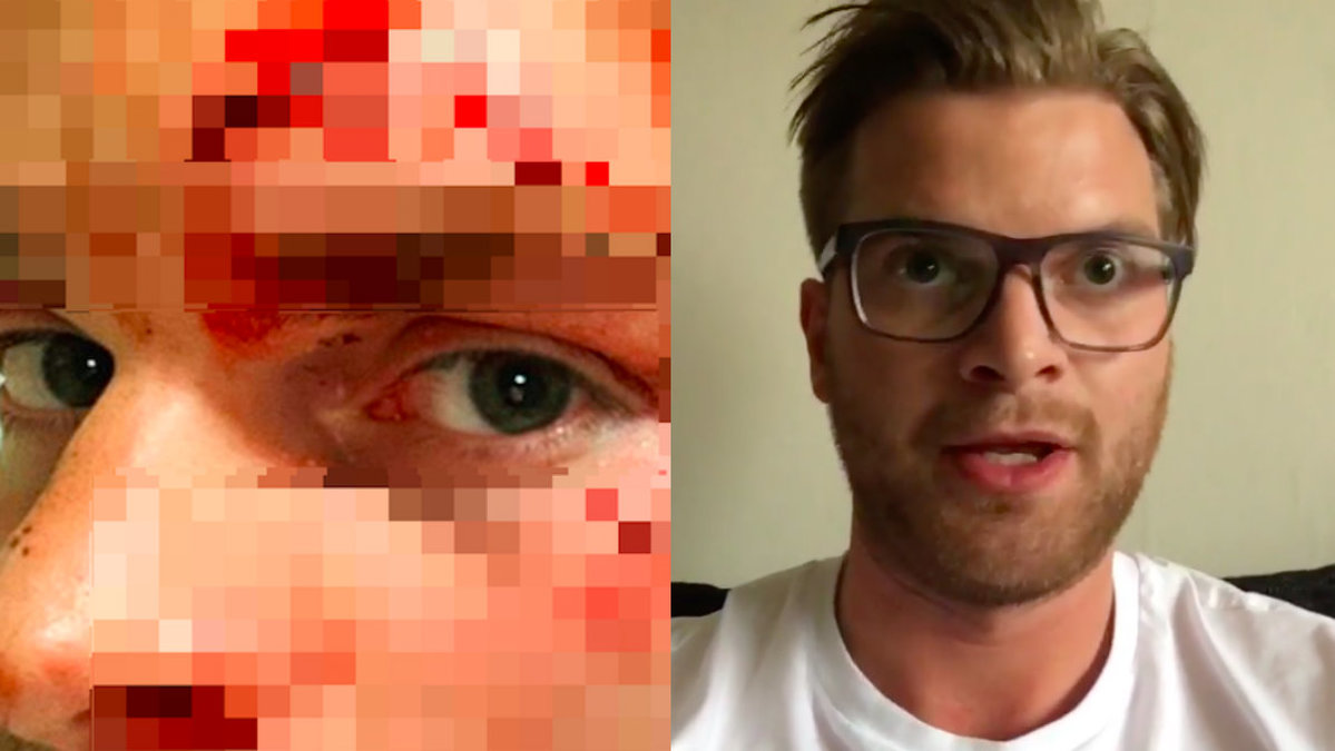 Lucas Simonsson i allvarlig olycka: "Glad att jag lever"