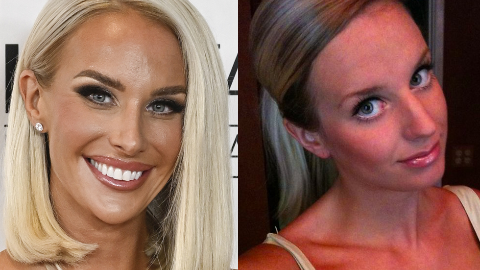 Julia Franzén ångrar skönhetsingreppet: "Mina ögon har försvunnit"