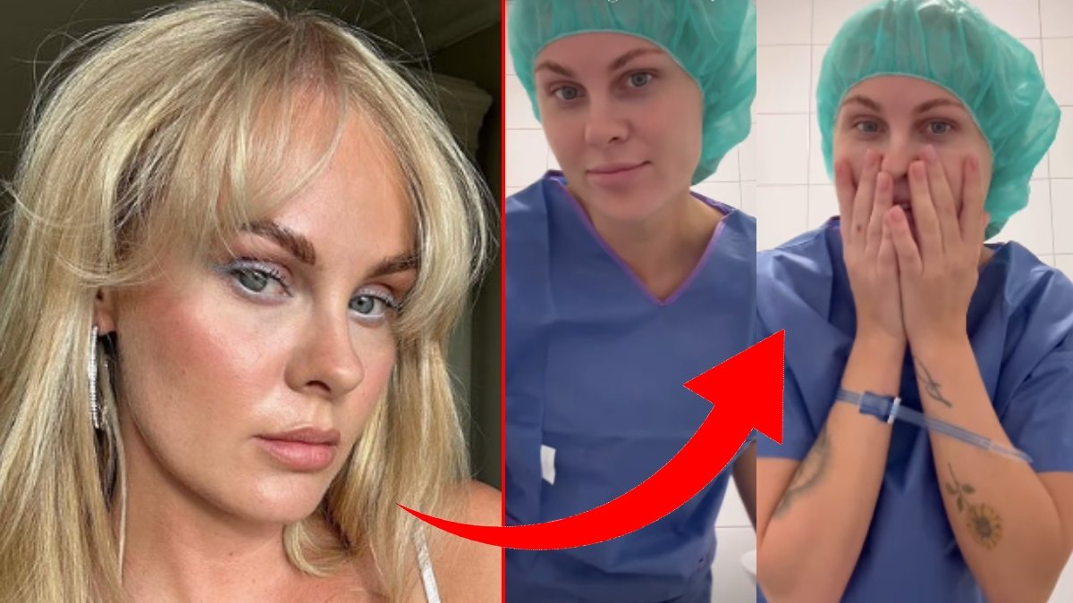 Sanna Guidettis nya operation: "Sågar i detta nu av min..."