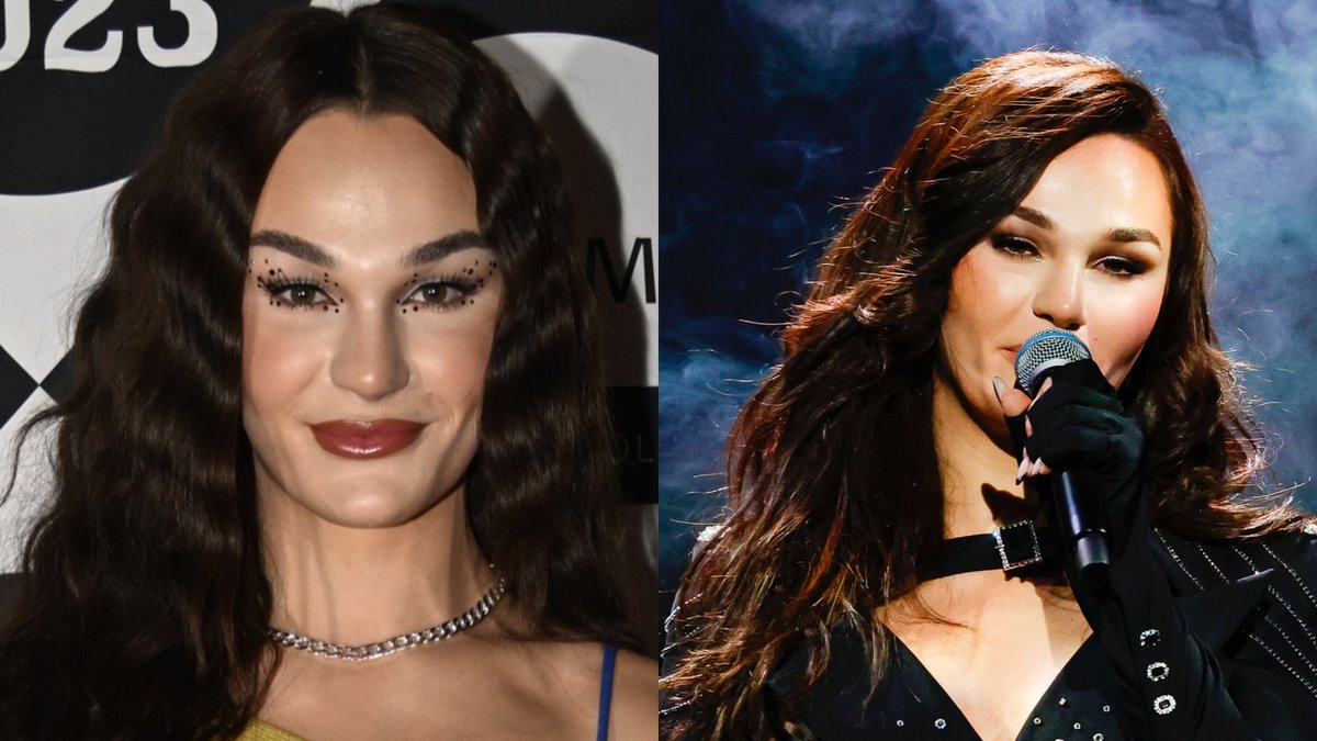 Tone Sekelius om sin bröstoperation: "Jag betalade allt själv"