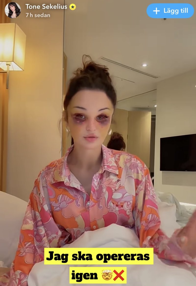 Tone Sekelius bakslag – tvingas till ny operation