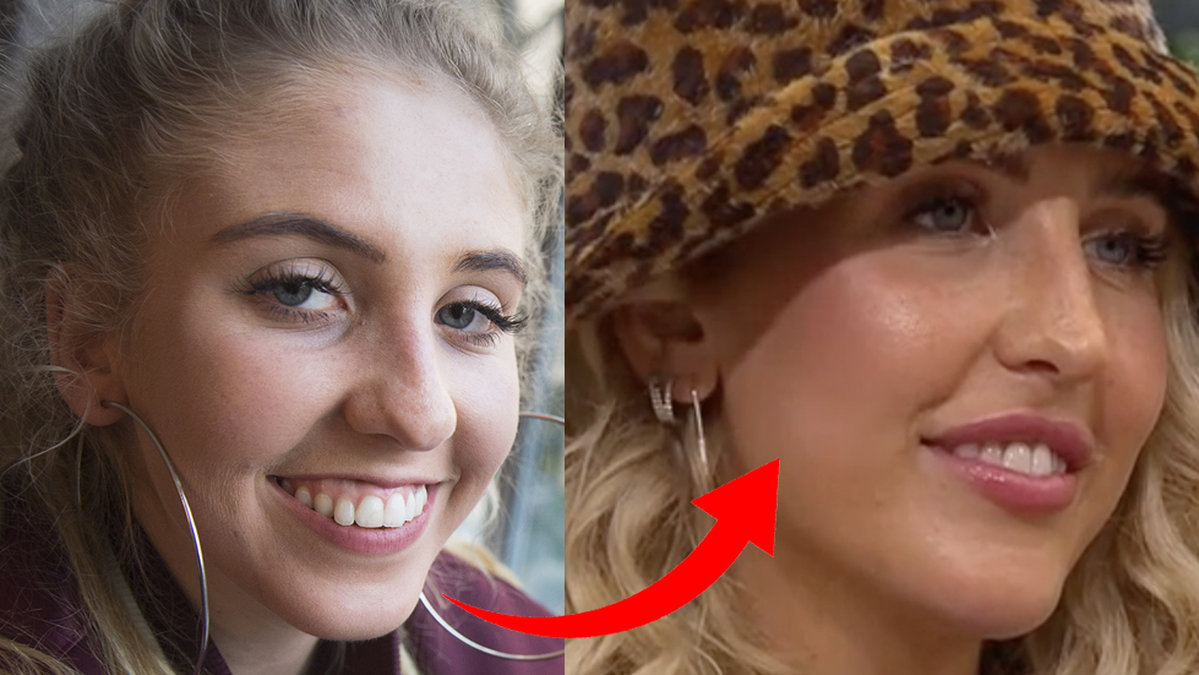 Peg Parnevik om att operera näsan och brösten: "Min sak"