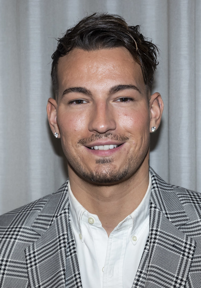 Efter skräckbilderna – Marcelo Peña gör ännu en skönhetsförändring