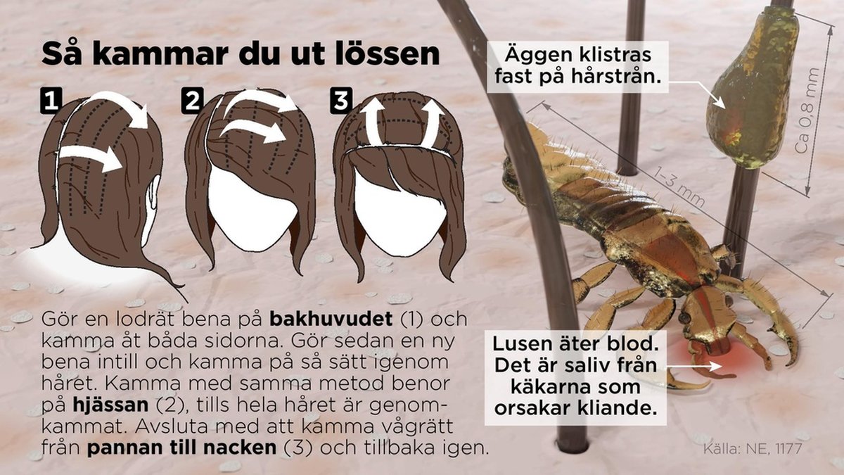 Högsäsong för lusen – så gör du