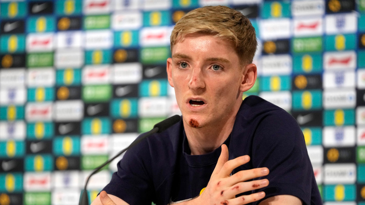 EM-spelare i cykelolycka: "Det sved"