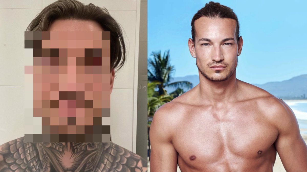 Skräckbilder spreds på Paradise Hotel-profilen Marcelo Peña