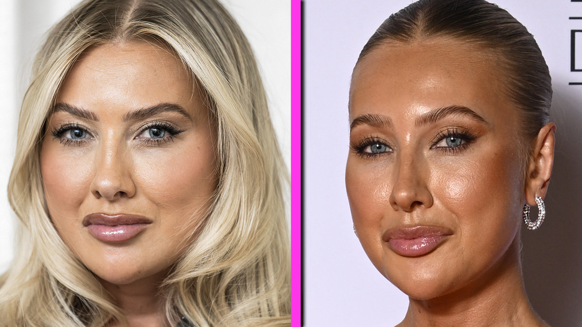 Allt om Hanna Friberg: Ex, operationer, pojkvän och bråk