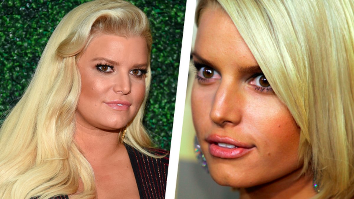 Jessica Simpson ångrar skönhetsoperationen – kunde ha dött