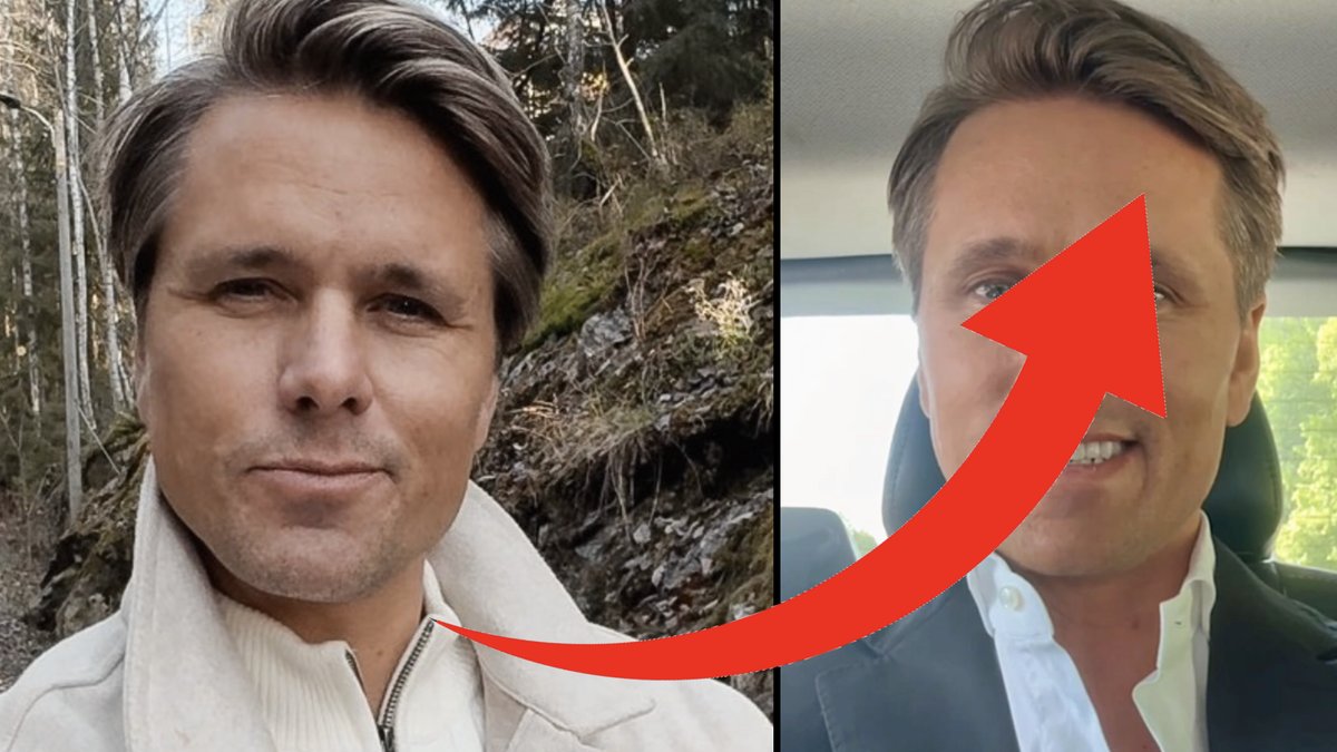 Jon Olsson hånas efter skönhetsingreppet: "Varför?"