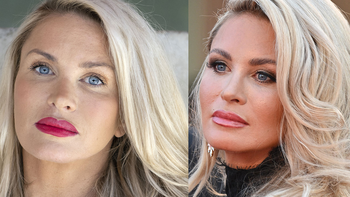 Carolina Gynnings ord efter bröstoperationen: "Jag ber om ursäkt.."