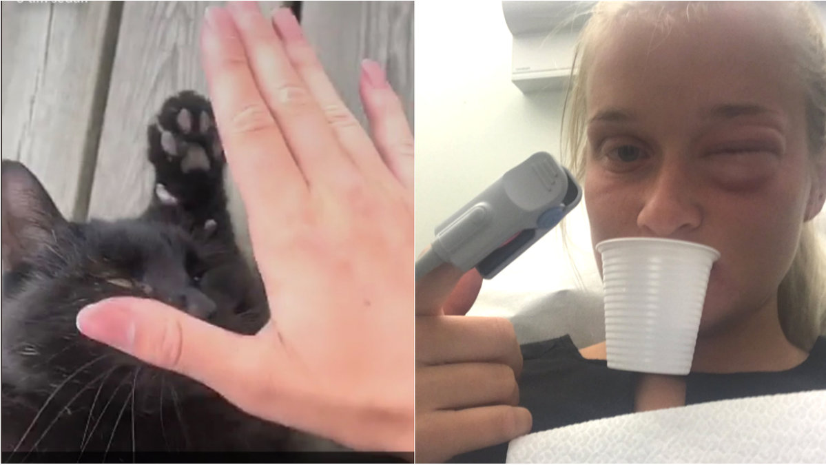 Julia, 19, klappade en katt – hamnade på sjukhus