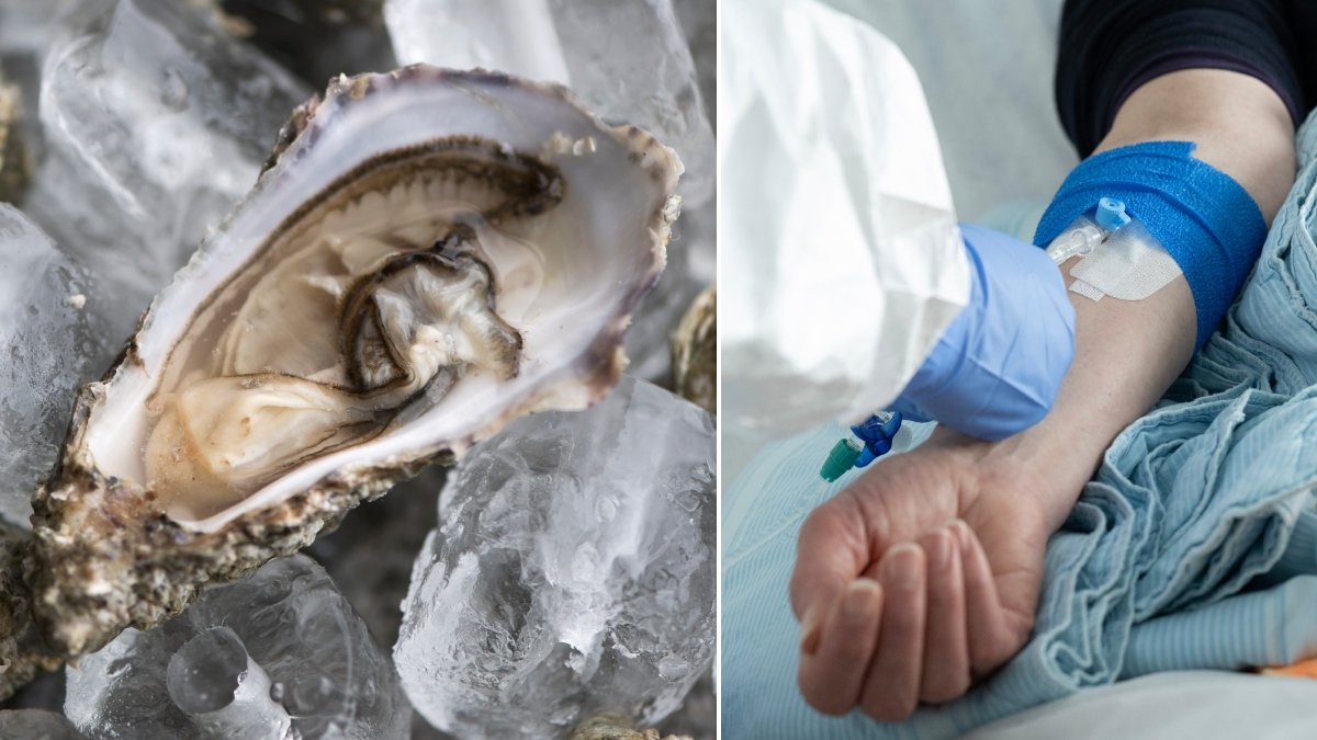 Flera döda efter att ha ätit ostron i Louisiana